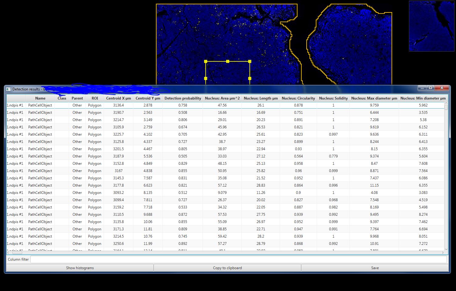 Distance analysis of multiplex immunofluorescent images in QuPath ...