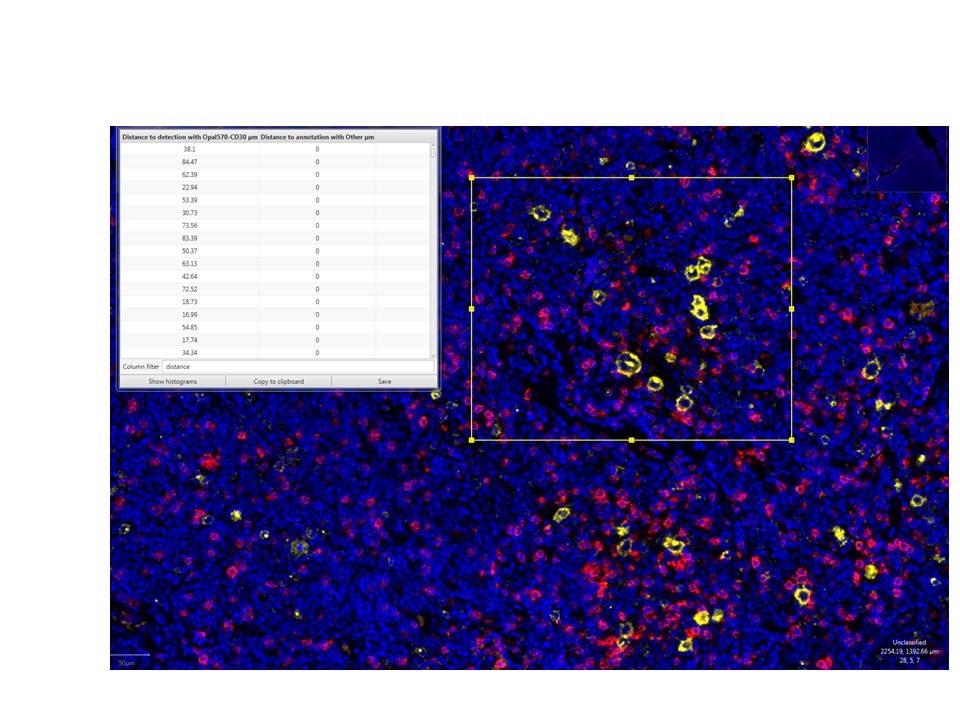 Distance analysis of multiplex immunofluorescent images in QuPath ...